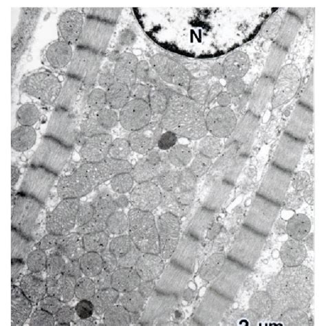 Electron Micrographs Following Ischemia And Reperfusion A Electron