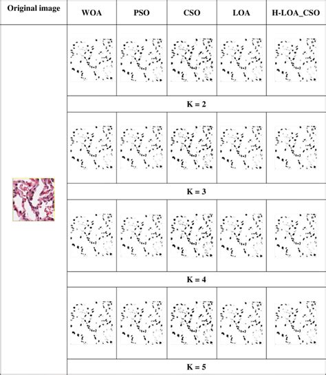 Lung Histopathological Image Segmentation Results Of Sample Image For K
