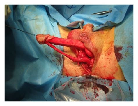 Different Steps In Surgical Procedure Download Scientific Diagram