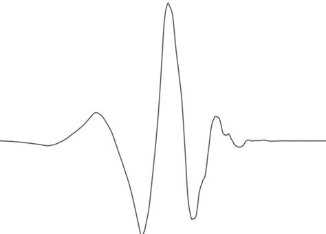Emotion Recognition Based On Brain Computer Interface Systems Intechopen