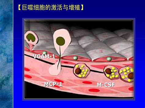 动脉粥样硬化 Word文档在线阅读与下载 无忧文档