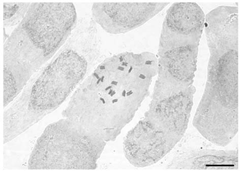 Root Tip Squash Showing 2n 18 Chromosomes For An Individual Of Download Scientific Diagram