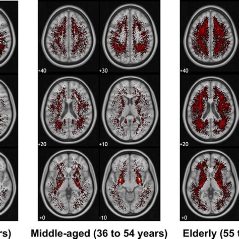 Maps Of Voxel‐wise Frequency Of Detecting Perivascular Spaces Across
