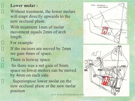 Vto Visualised Treatment Objective