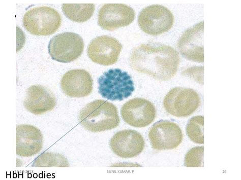 Reticulocyte Count