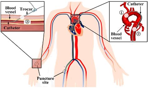 Figure 11 From Development Of A High Sensitivity Proximal Force Torque Sensor Based On Optical