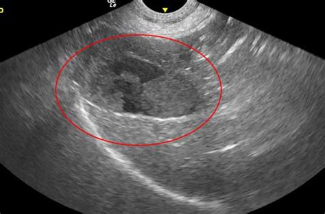What Are The Symptoms Of Gallstones In Dogs