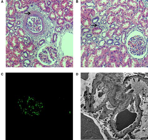 Histopathologic Lesions A Hande Stain ×200 Showing Glomeruli