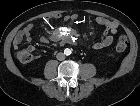 Mesenteric Pathologic Conditions Interactive Case Based Approach