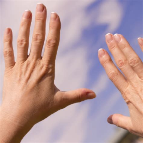 Insights Into Rheumatoid Arthritis The Arthritis Connection