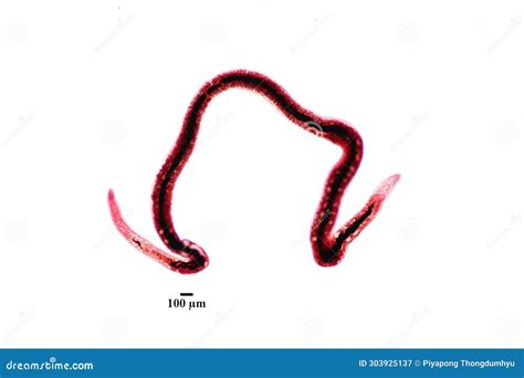 Thorny Headed Worms Or Spiny Headed Worms And Ascaris Under The