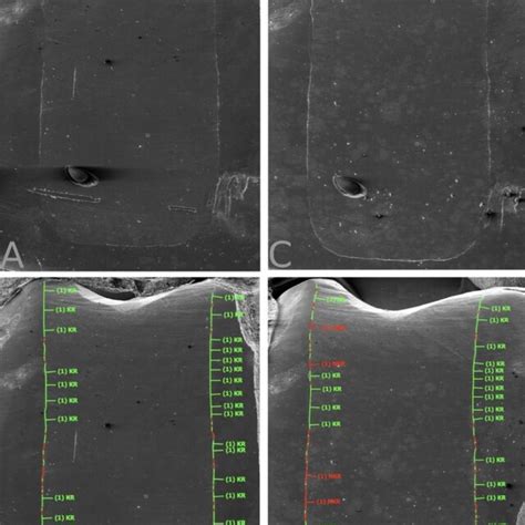 Sem Images And The Quantitative Margin Analysis For A Restorations Download Scientific Diagram