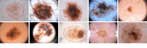 Figure 1 From Deu Net Dual Encoder U Net For Automated Skin Lesion Segmentation Semantic Scholar
