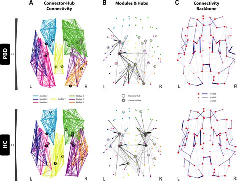 Disrupted Modularity Hubs And Connector Hub Connectivity In Patients Download Scientific