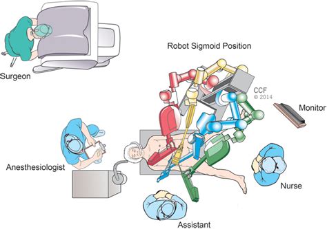 How Has The Robot Contributed To Colon Cancer Surgery Pmc
