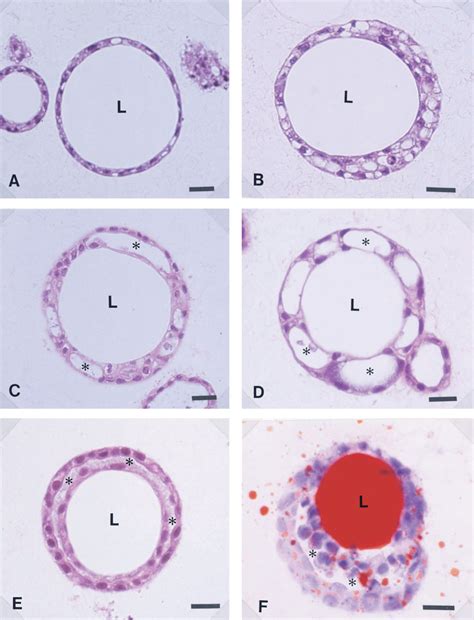 Morphogenesis Of Mdck Cells In A Collagen Gel Matrix Culture Under