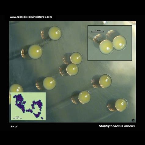 Staphylococcus Aureus Colony Morphology Pigment Staphyloxanthin And
