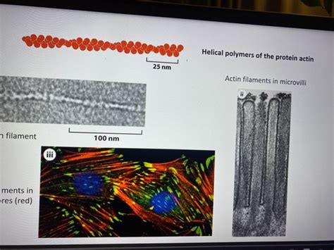 Cytoskeleton Cell Biology Life Processes Part A Flashcards Quizlet