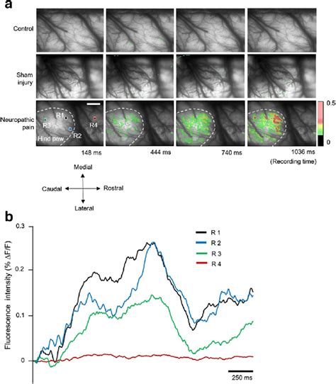 Spatiotemporal Neural Activity After Electrical Stimulation Of The Download Scientific Diagram