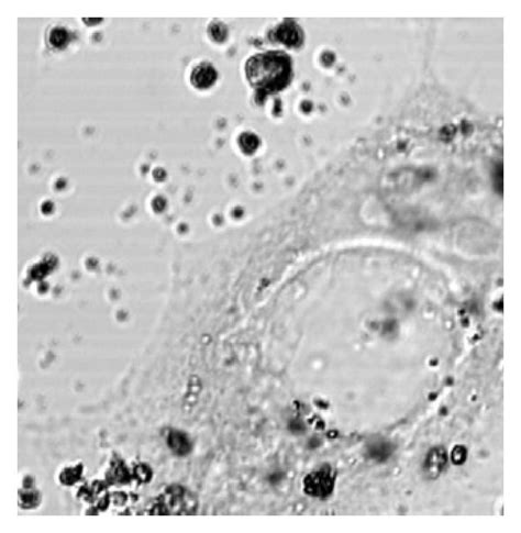 Localization Of Crystalline Anatase And Rutile Tio2 Nps In Hepg2 Cells Download Scientific