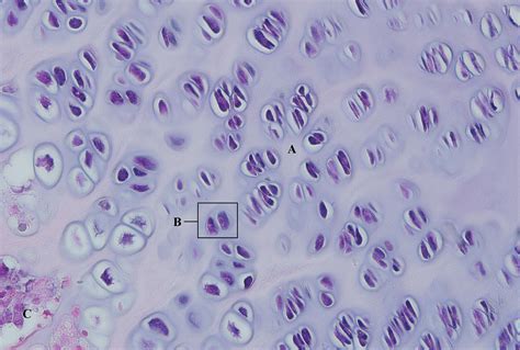 Elastic Cartilage Labeled Elastic Cartilage Light Micrograph Stock