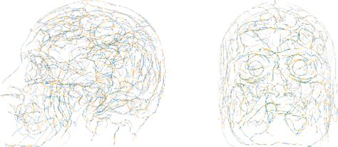 Figure 8 From Chapter 31 Landmark Based Registration Using Features Identified Through