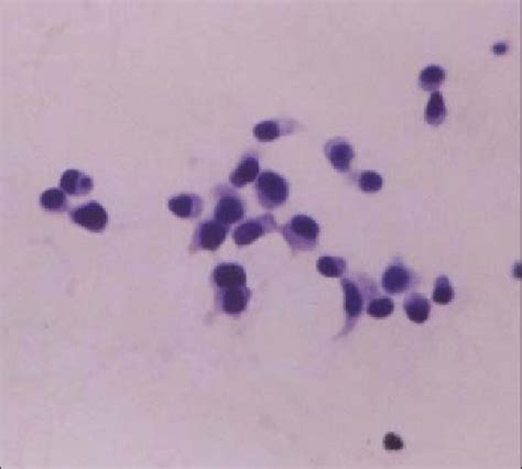 Cytological Smear Shows Columnar Cells With Basally Placed Hyper