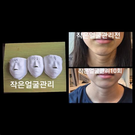 실화임 실화입니다 수술없이 갸름하고 예쁜턱선 사람의첫인상은 인간관계에서도 좋은이미지를 준다고하죠 당진유일무이한 다정뷰티케어에 오시면 예뻐집니다 당진다정뷰티케어