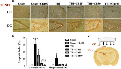 Results Of Apoptosis By Tunel Staining In Both Cerebral Cortex Cc And Download Scientific