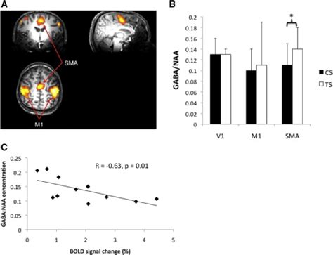 Results Of Brain Imaging Analyses Download Scientific Diagram