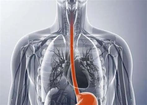 局部晚期食管癌无法手术，新疗法精准攻击癌细胞，实现患者治愈 知乎