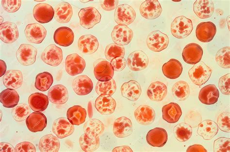 Exploraciones De Eritrocitos Análisis Forense De Sangre Foto Premium