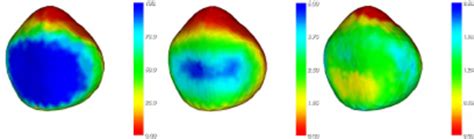 First Two Modes √ Of Variation For √ The Patella Bone Ssm − 3 λ − λ