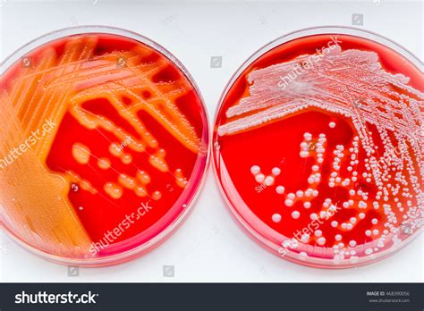 Alpha Hemolysis 81 รายการ ภาพ ภาพสต็อกและเวกเตอร์ Shutterstock Alpha Hemolysis 81 รายการ ภาพ ภาพสต็อกและเวกเตอร์ Shutterstock