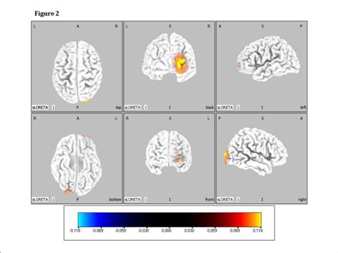 New Partial Connectivity Map Lleft Rright Aanterior Pposterior
