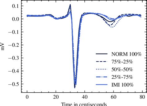 Figure 4 From Diffusion Based Conditional Ecg Generation With Structured State Space Models