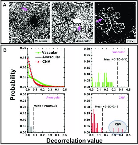 demonstration of the rationale for the pathologic angiogenesis