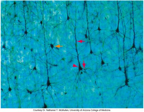 Neuro Cerebral Cortex Flashcards Quizlet Neuro Cerebral Cortex Flashcards Quizlet