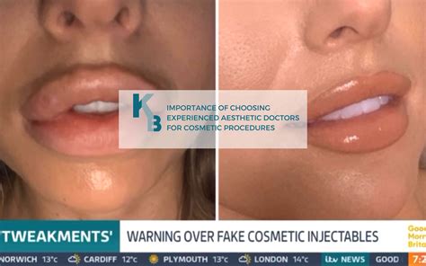 Importance Of Choosing Experienced Aesthetic Doctors