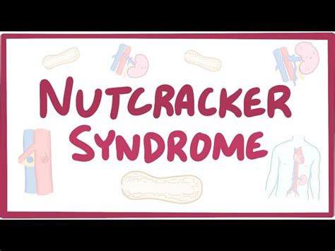 Renal Nutcracker Syndrome Causes Symptoms Diagnosis Treatment