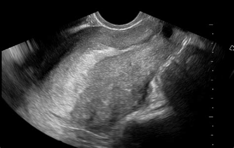 Ultrasound Machine Basics Knobology Probes And Modes Pocus 101