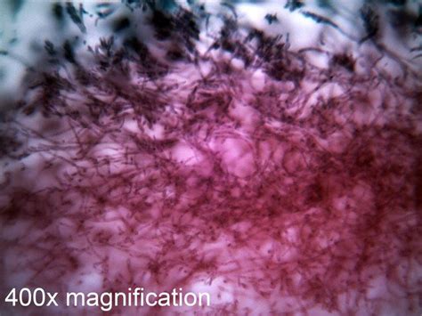 Penicillium Under Microscope 400x