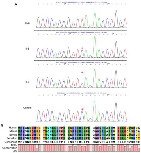 Sequencing Analysis Results A Proband Ⅲ 6 Has An Download