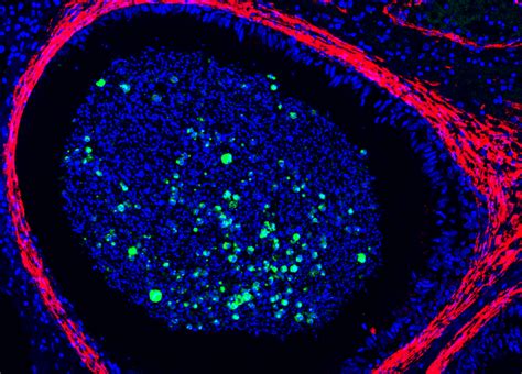 Monkeypox Found In Monkey Testes Highlights Potential For Sexual Transmission