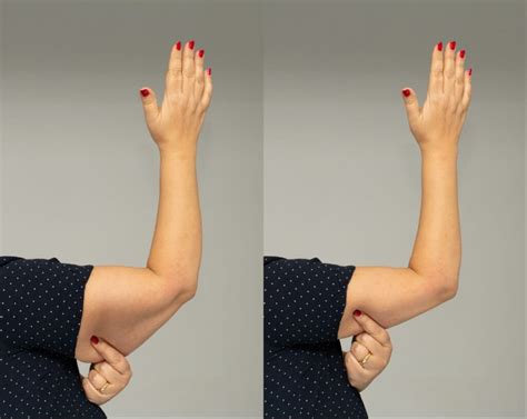 What You Need To Know About Plastic Surgery After Weight Loss Oneill