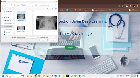 Pneumonia Detection Using Deep Learning Pneumonia Detection