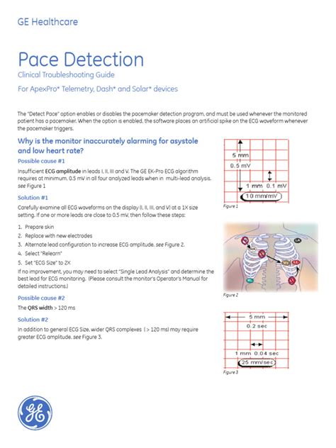 Pace Detectionclinical Troubleshooting Guidedoc1018666 Pdf Electrocardiography