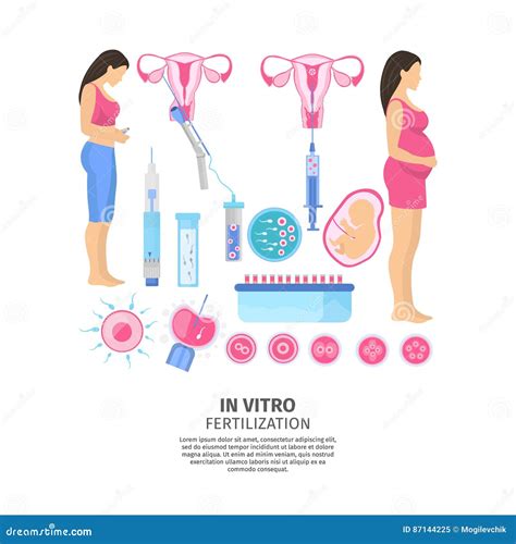 Flat In Vitro Fertilization Ivf Infographics Vector Illustration Cartoondealer Com