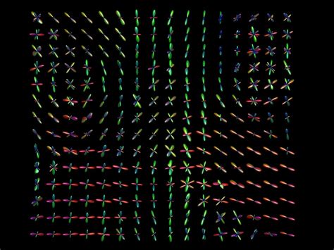 ExploreDTI Image Gallery