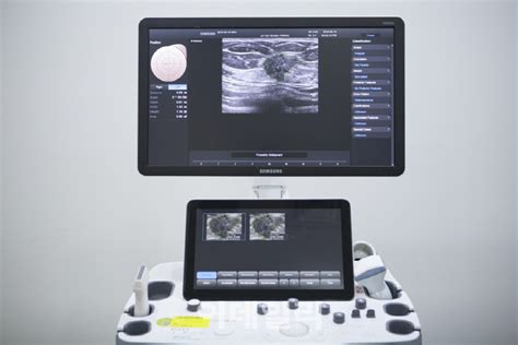 삼성메디슨 세계최초 딥러닝 기술접목 유방암 진단기기 개발